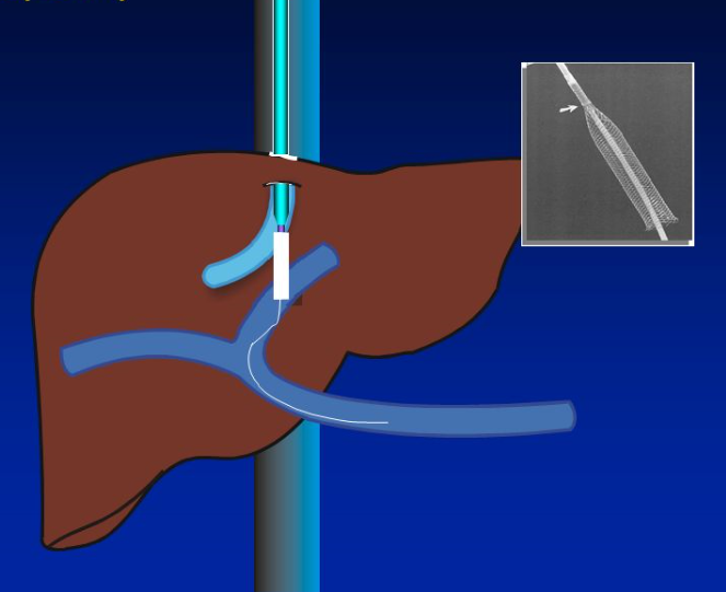 Procedimentos - Octávio Galvão